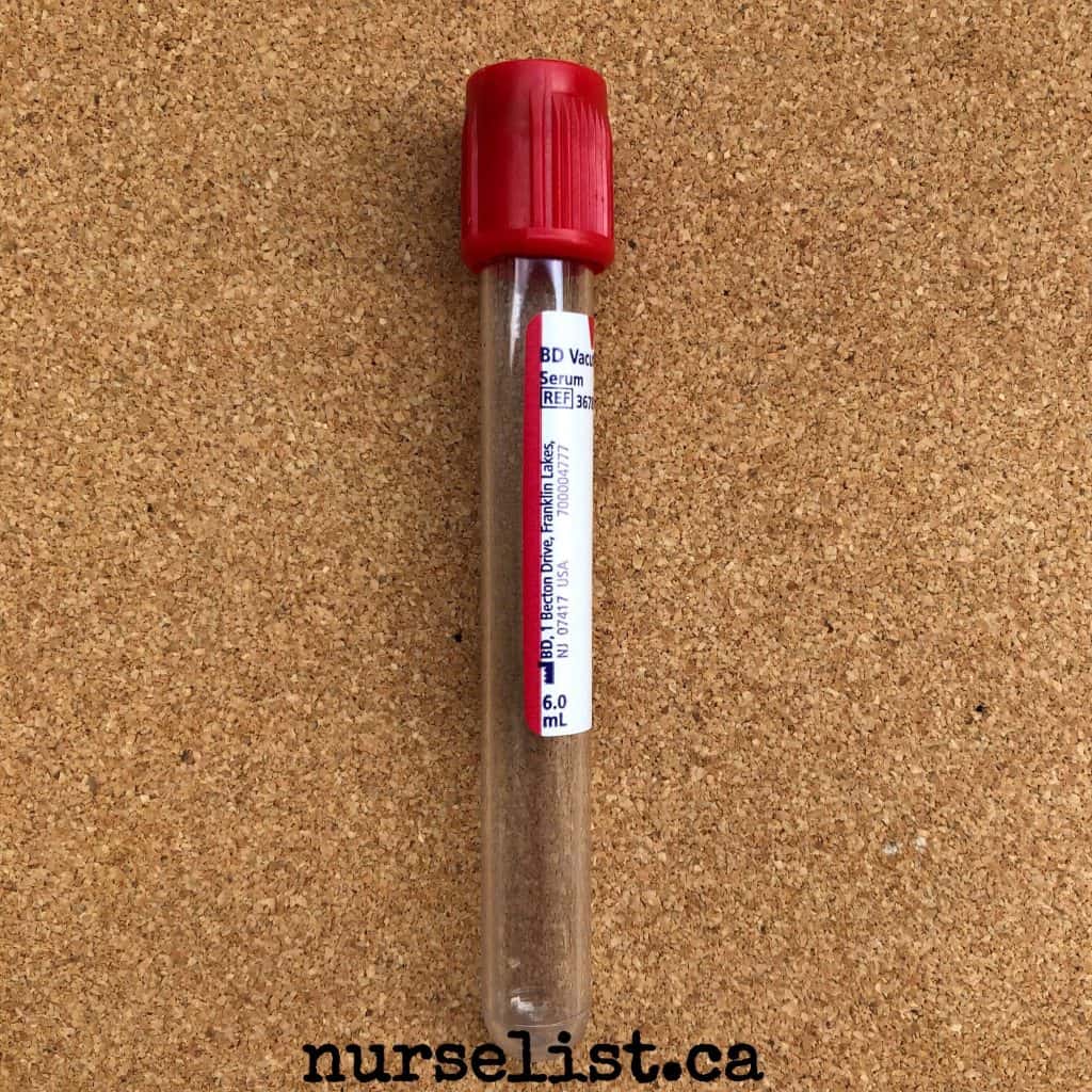 How to Remember The Order of Draw & What Tubes Are Used For What Blood ...