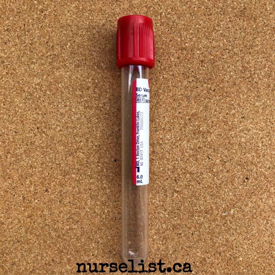 How to Remember The Order of Draw & What Tubes Are Used For What Blood ...