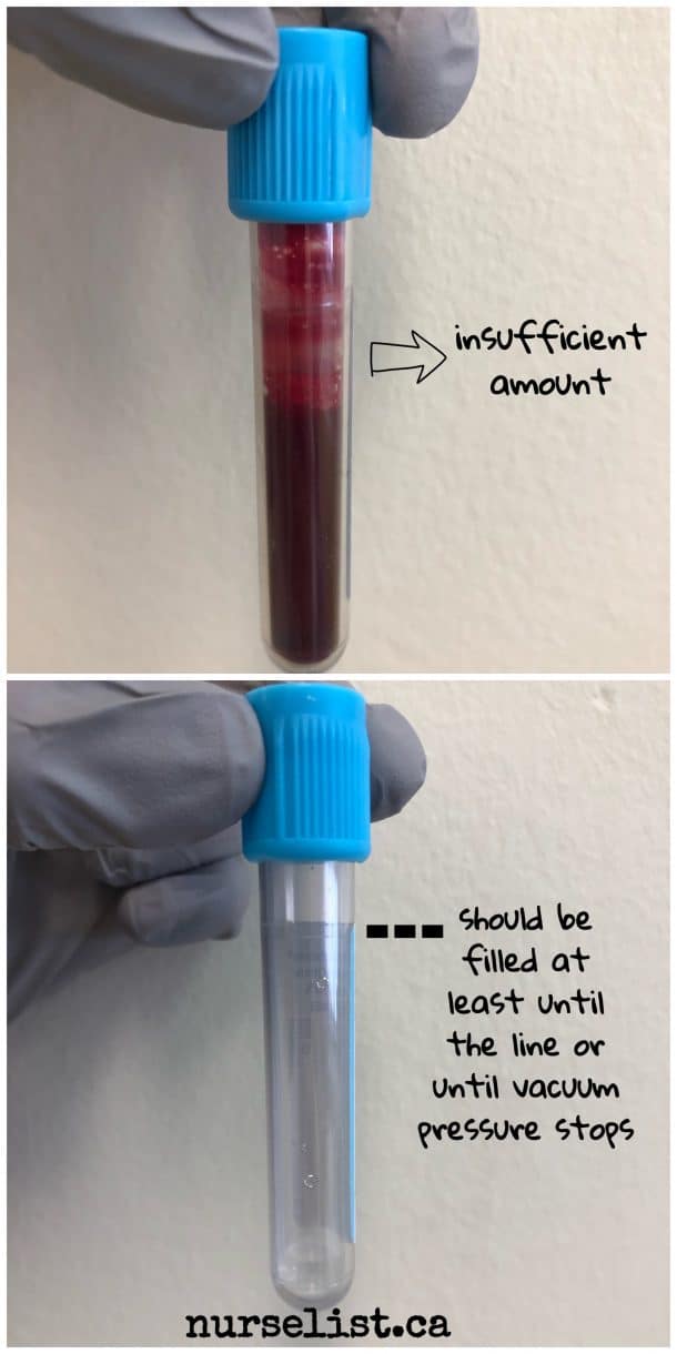7 Common Mistakes of Nurses When Doing Blood Draws - Nurse List